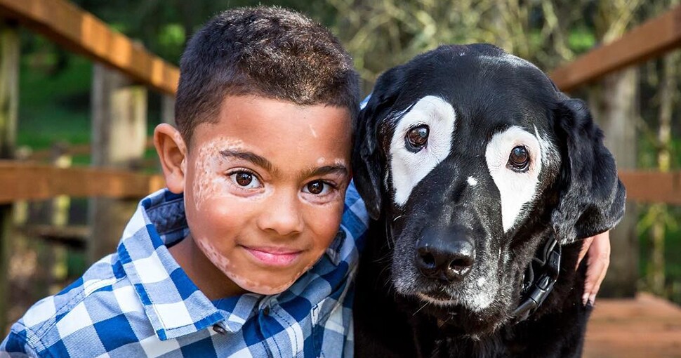¡Enternecedora historia! Niño y perro con vitíligo se convierten en los ...